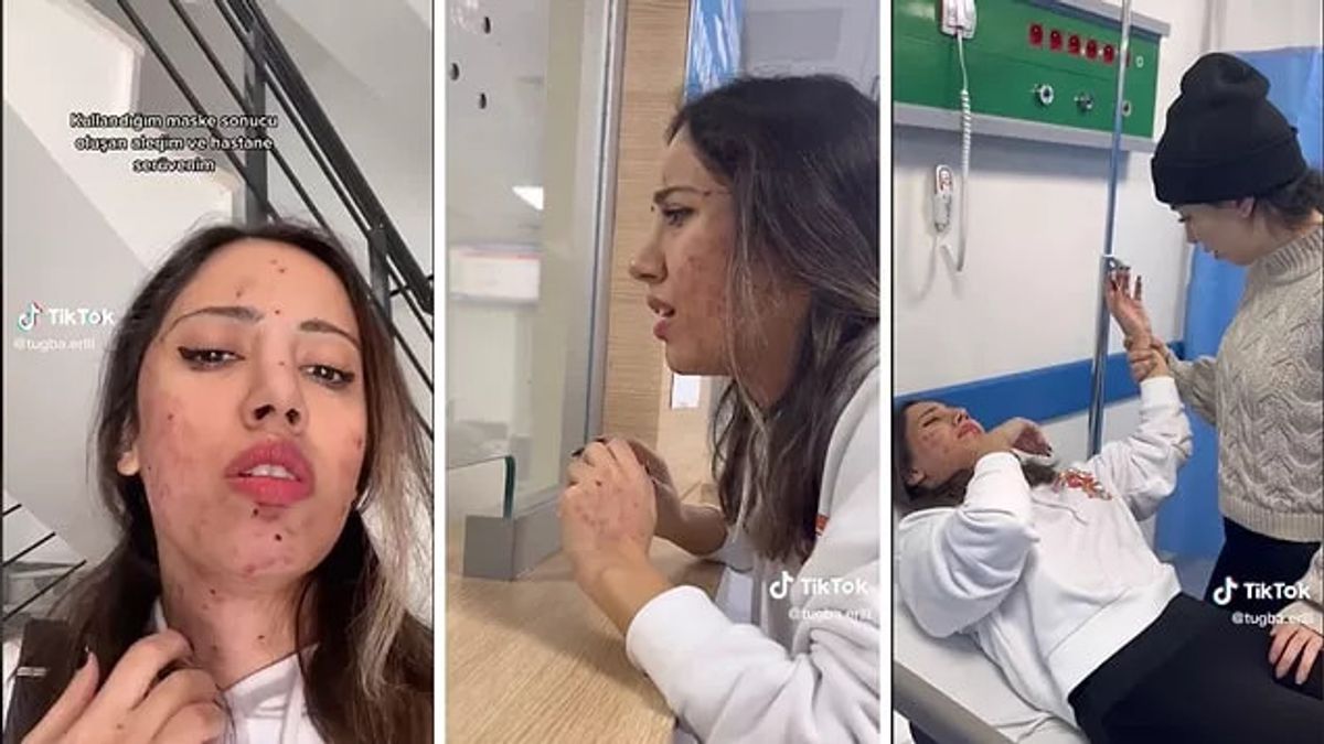 Sivilce maskesi yüzünden acillik olan TikTok fenomeni Sivilce maskesi yüzünden acillik olan TikTok fenomeni