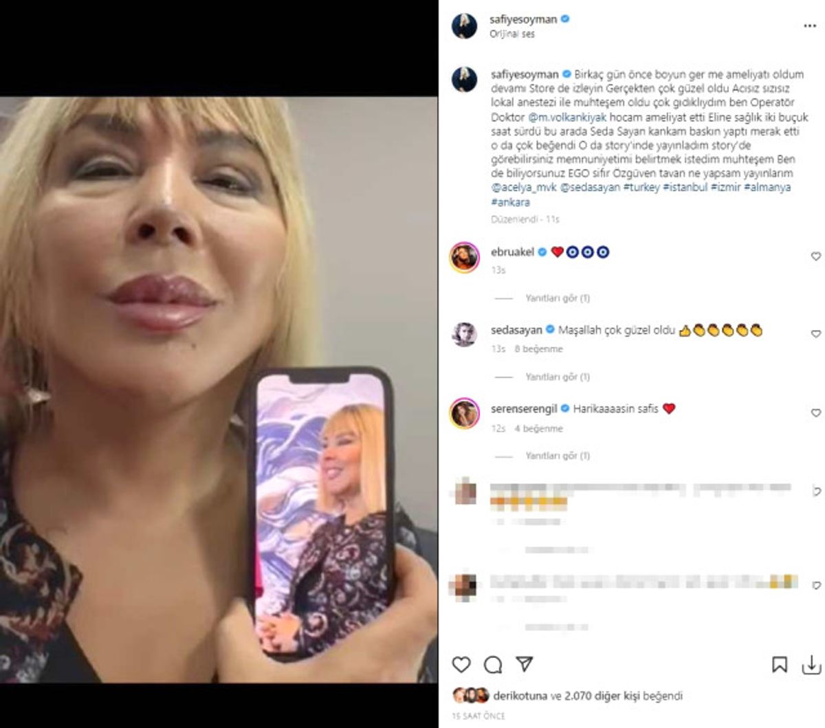 Safiye Soyman, boyun germe ameliyatı oldu