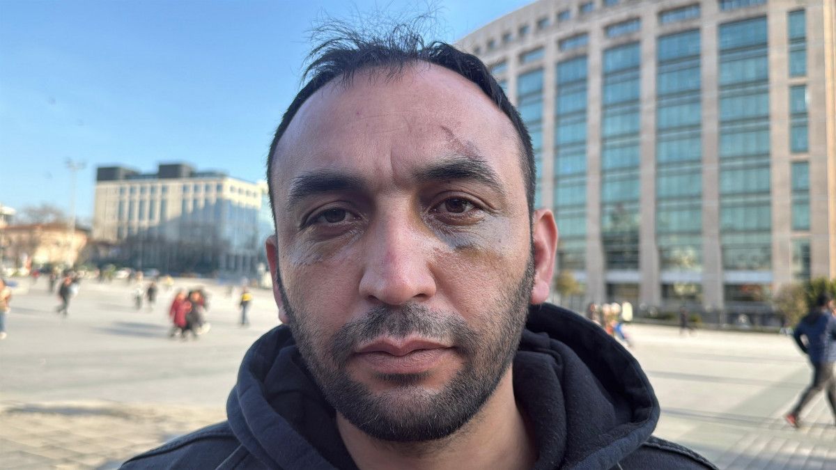 İstanbul'da eski sevgilisinin evinde dayak yiyen adam