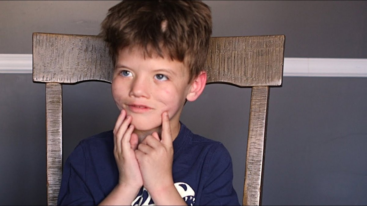 Moebius sendromu nedir