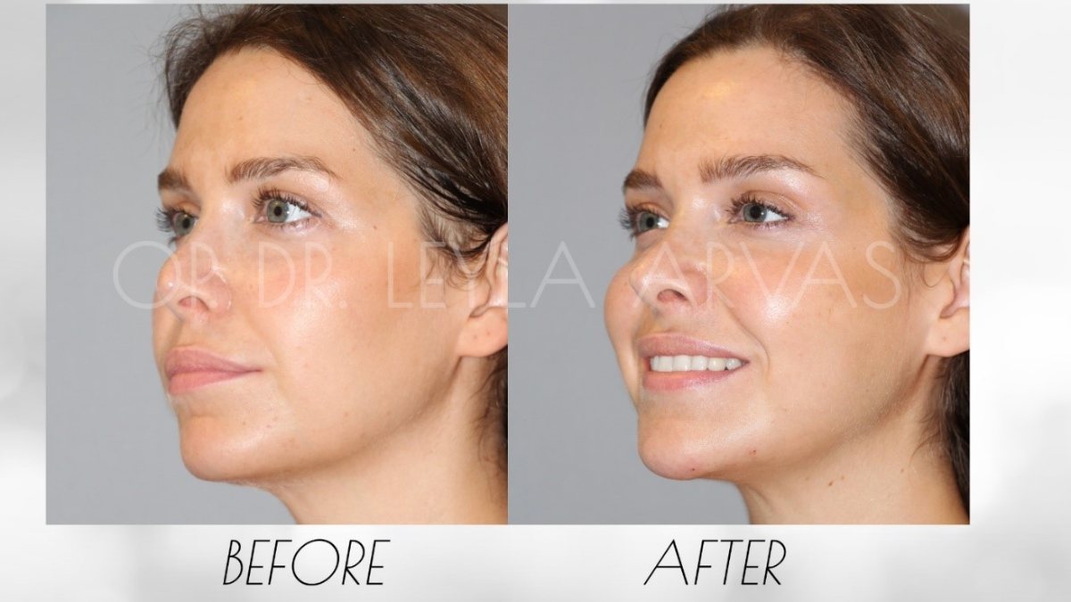 New Appearance on Bottom Side. Rejuvenate with the Combination of ...