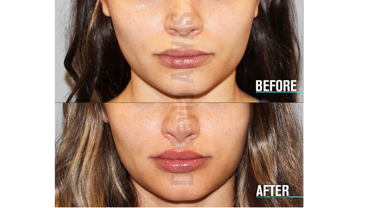 The duo that captures the perfection of the lips! Which lip touch is ...