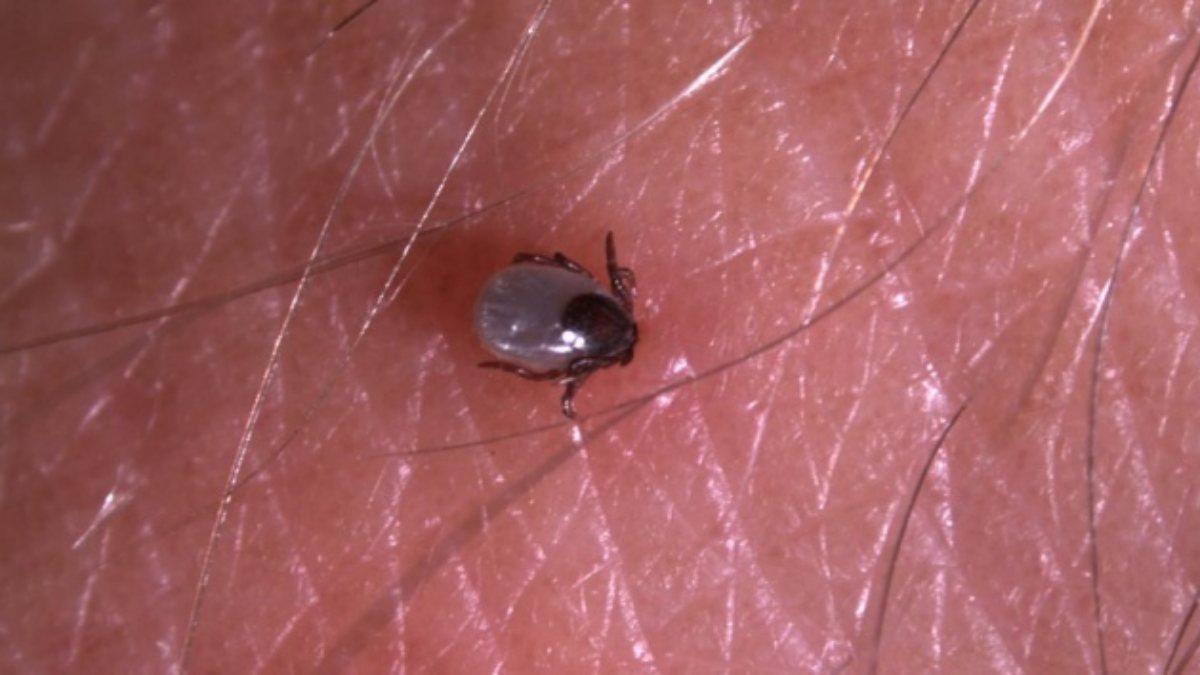Making a special solution that keeps ticks away – Kimdeyir