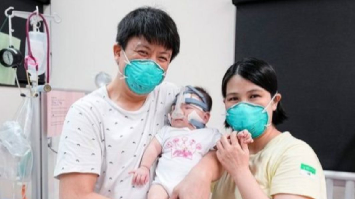 ‘World’s smallest baby’ wins battle for survival – Kimdeyir