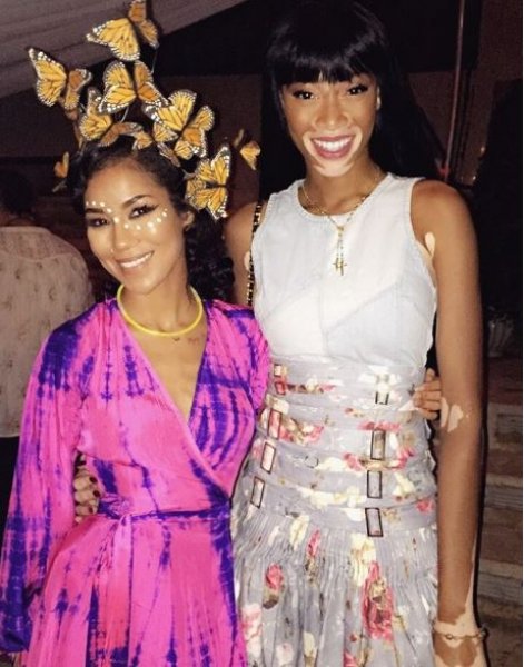 Winnie Harlow'dan Michael Jackson isyanı - Magazin haberleri