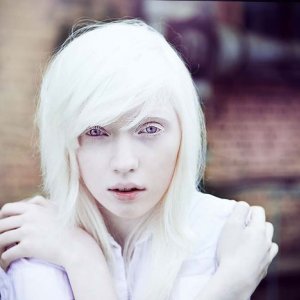 Benzersiz ten rengine sahip 8 farklı insan | Ensonhaber