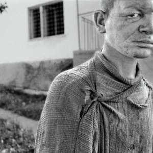 Savaşın insanlar üzerindeki korkunç etkisi | Ensonhaber