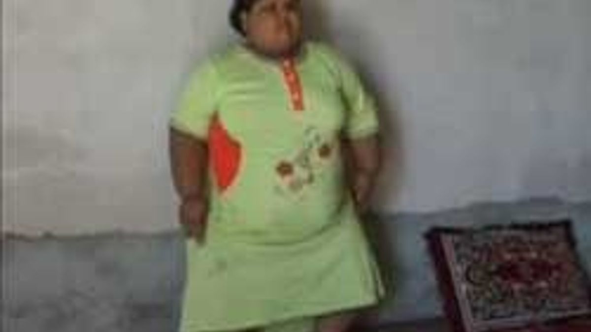 7 yaşında 110 kilo