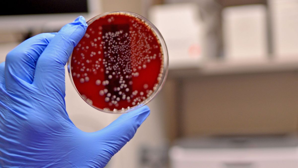 Deprem illerinde "Gaita testi" önlemi! Gaita testi nedir, ne işe yarar ...