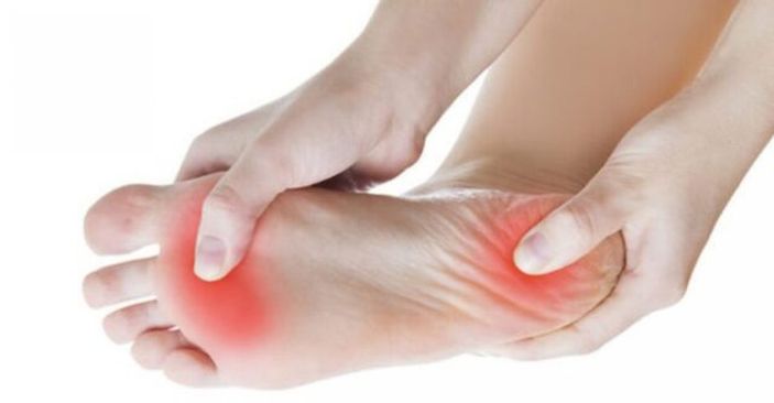 Plantar Fasiit nedir